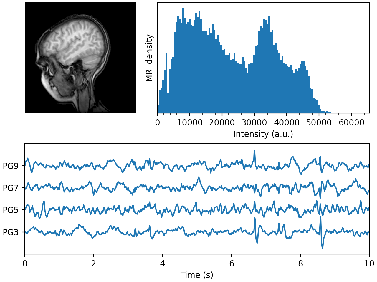 MRI与脑电图 — Matplotlib 3.10.3 文档 - Matplotlib 绘图库